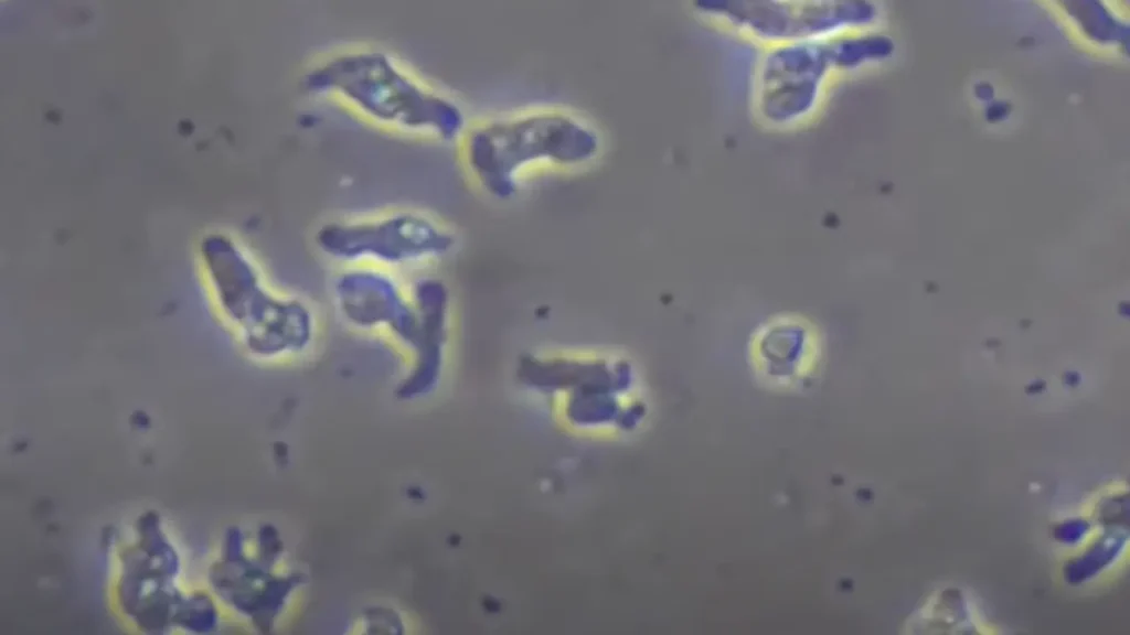 Objasnění mozkožravé améby: Přírodní fenomén, který vyvolává obavy ...